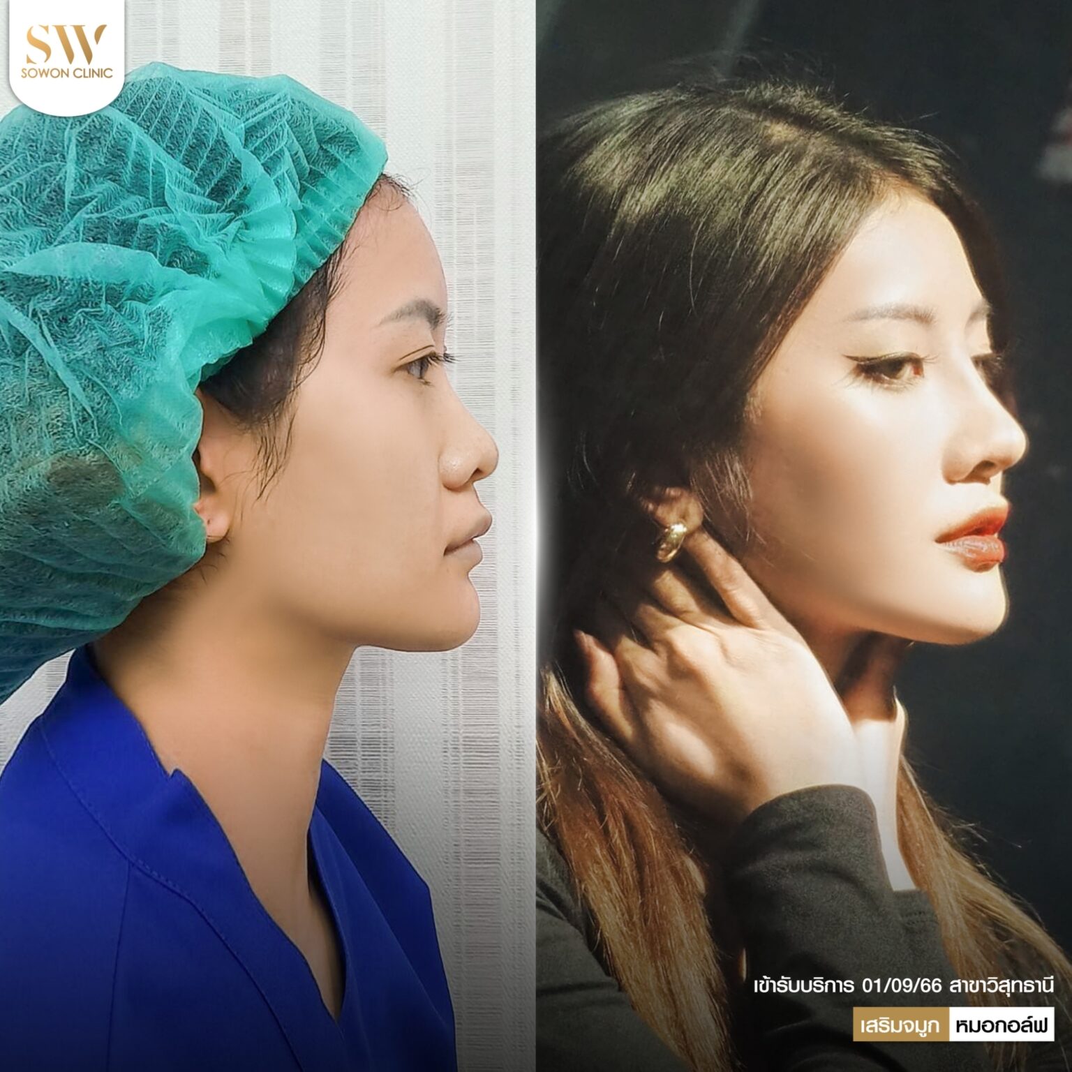 ทีมแพทย์ Sowon Clinic : หมอกอล์ฟ - SoWon Clinic