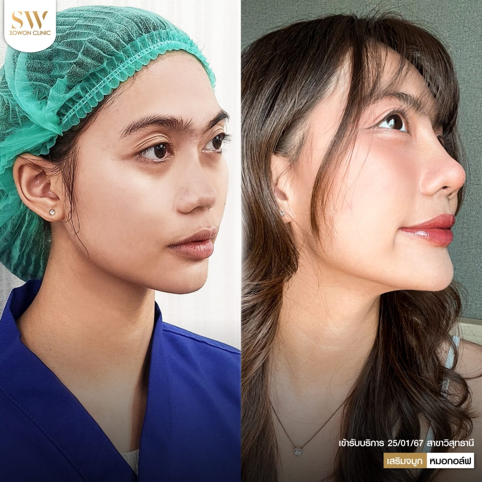 ทีมแพทย์ Sowon Clinic : หมอกอล์ฟ - SoWon Clinic