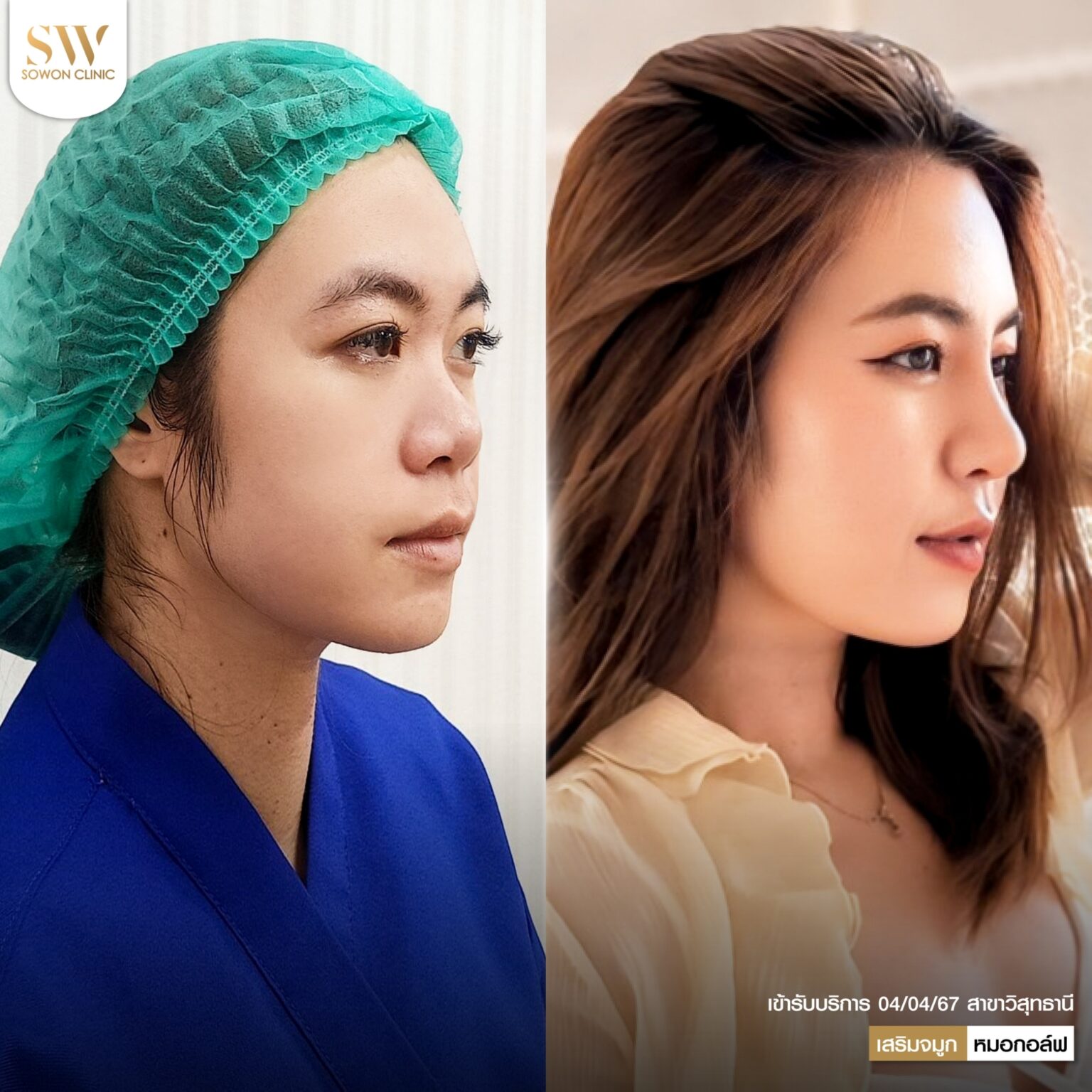 ทีมแพทย์ Sowon Clinic : หมอกอล์ฟ - SoWon Clinic