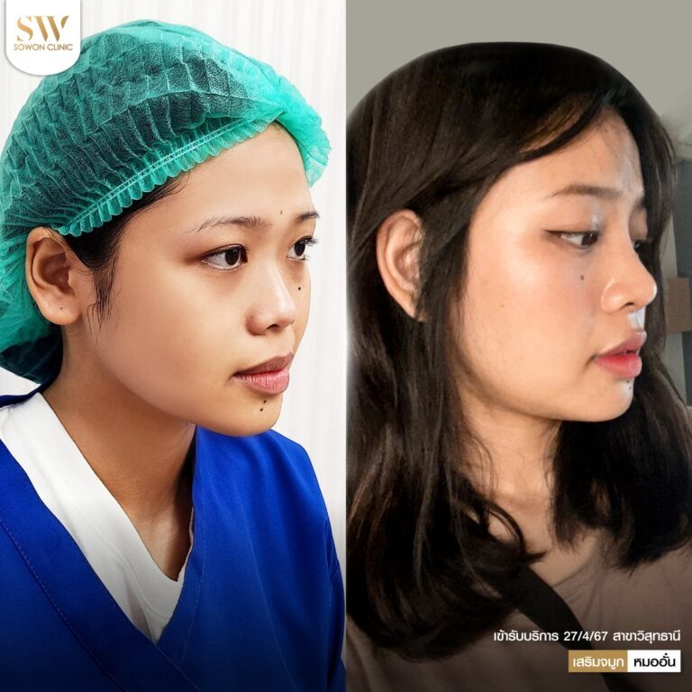 ทีมแพทย์ Sowon Clinic : หมออั๋น - SoWon Clinic